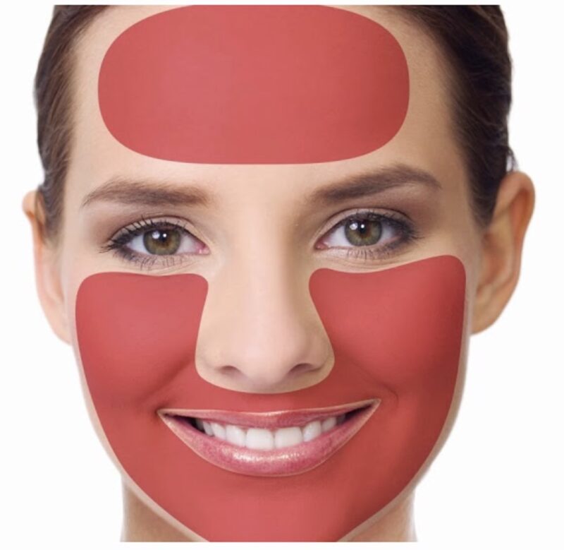 4D Fotona veido atjauninimas lazeriu - REVÙ CLINIC